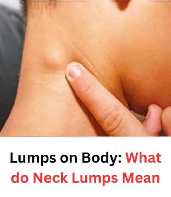 What do Neck Lumps Mean – Viral Daily